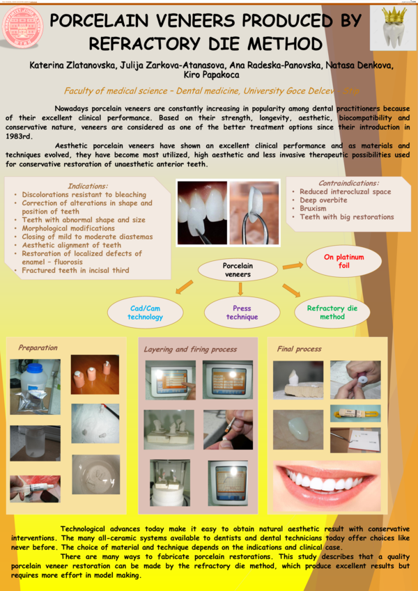 (PDF) Porcelain veneers produced by refractory die method