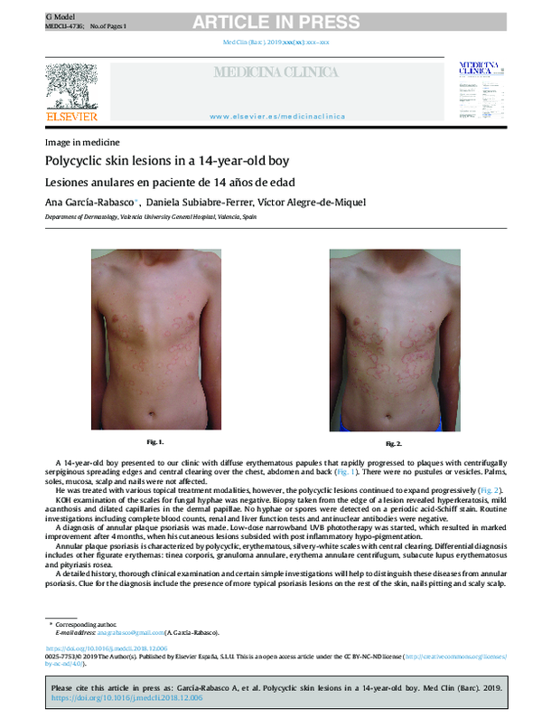(PDF) Polycyclic skin lesions in a 14-year-old boy