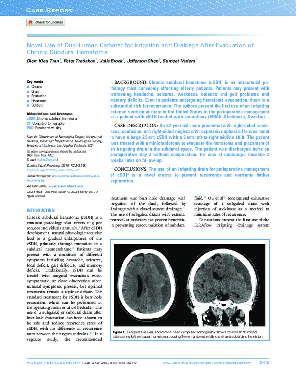 (PDF) Novel Use of Dual-Lumen Catheter for Irrigation and Drainage After Evacuation of Chronic ...