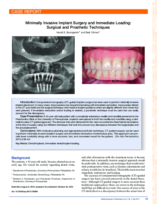 (PDF) Minimally Invasive Implant Surgery and Immediate Loading ...