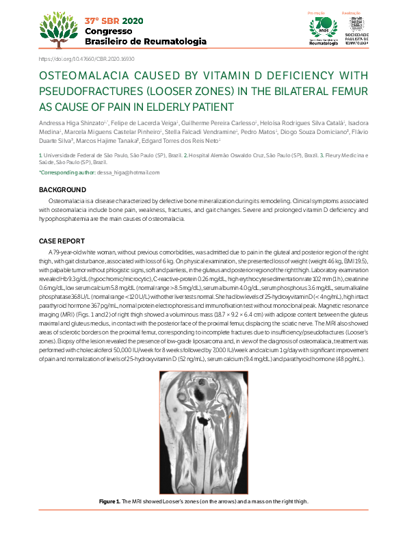 (PDF) Osteomalacia Caused by Vitamin D Deficiency with Pseudofractures ...