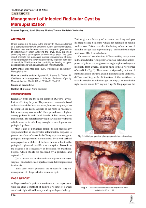 (PDF) Management of Infected Radicular Cyst by Marsupialization