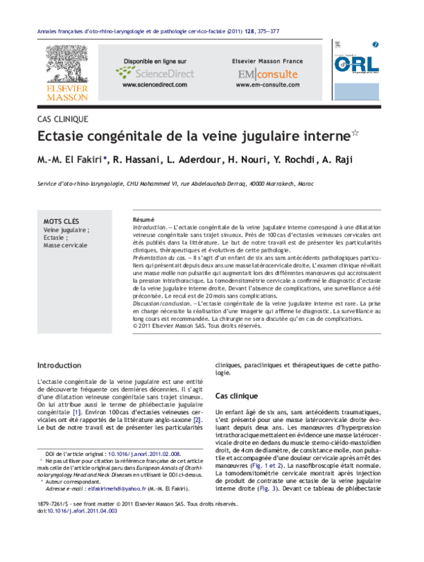 (PDF) Ectasie congénitale de la veine jugulaire interne
