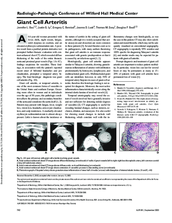 (PDF) Giant Cell Arteritis