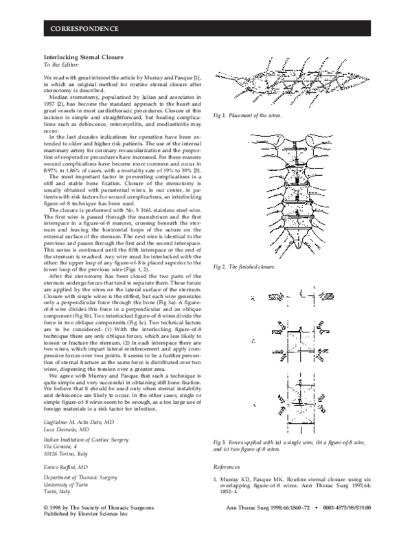 Pdf Interlocking Sternal Closure [1] Multiple Letters