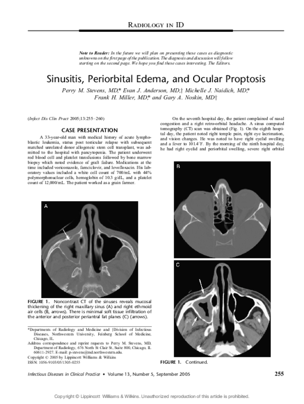 (PDF) Sinusitis, Periorbital Edema, and Ocular Proptosis