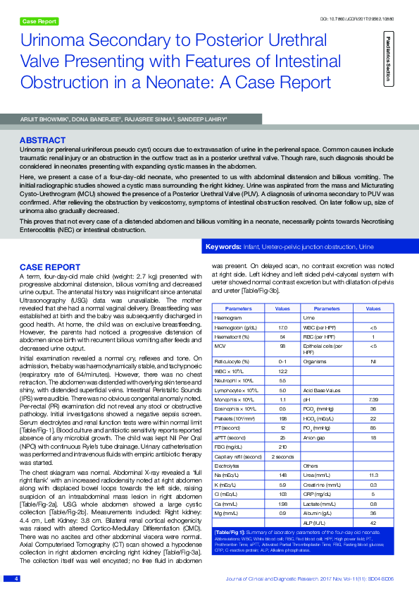 (PDF) Urinoma from Urethral Valve in Neonate Case