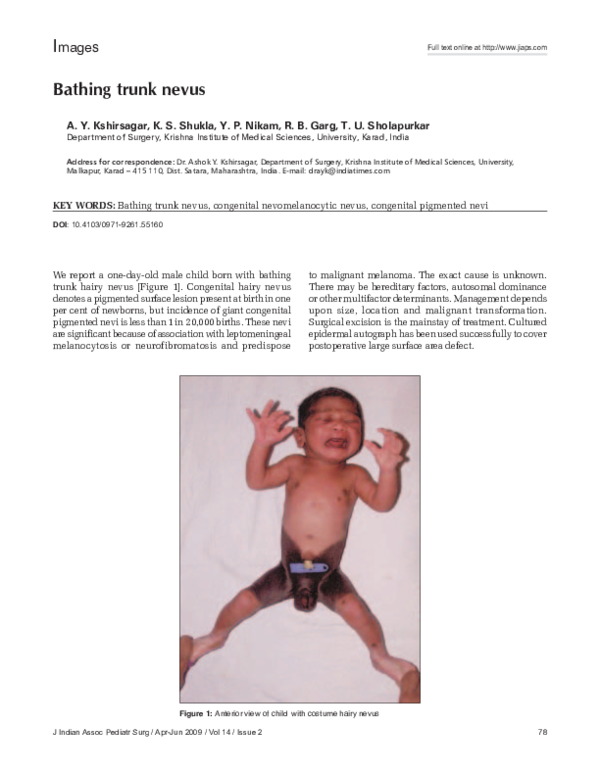 Pdf Bathing Trunk Nevus