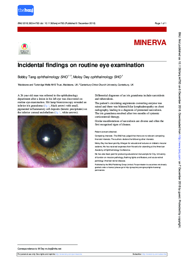 (PDF) Incidental findings on routine eye examination
