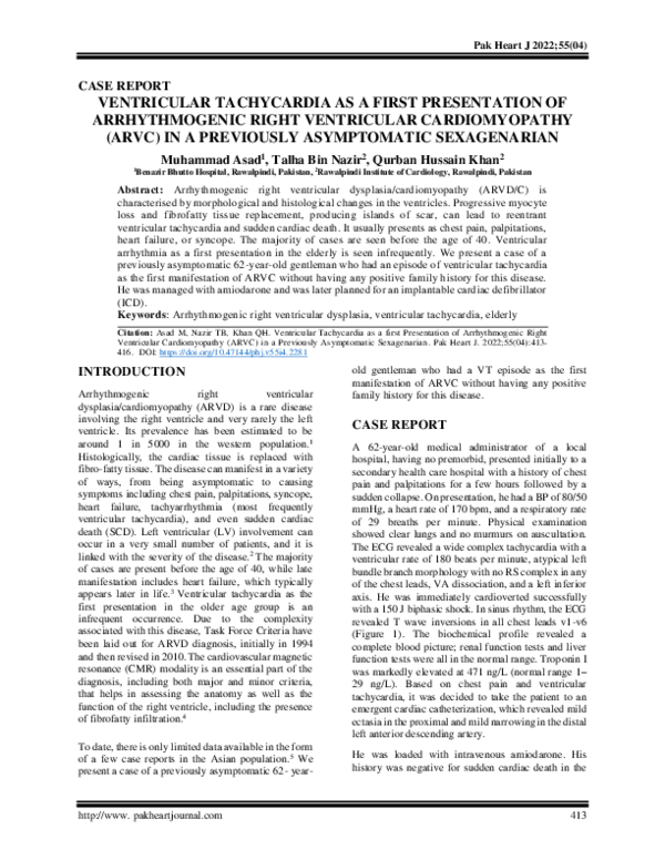 (PDF) Ventricular Tachycardia as a First Presentation of Arrhythmogenic ...