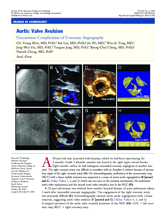 (PDF) Aortic Valve Avulsion