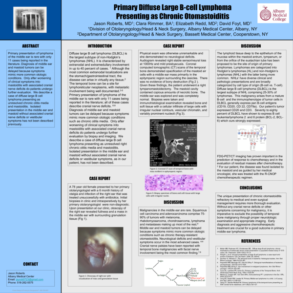 (PDF) Primary Diffuse Large B-Cell Lymphoma Presenting as Chronic Otomastoiditis