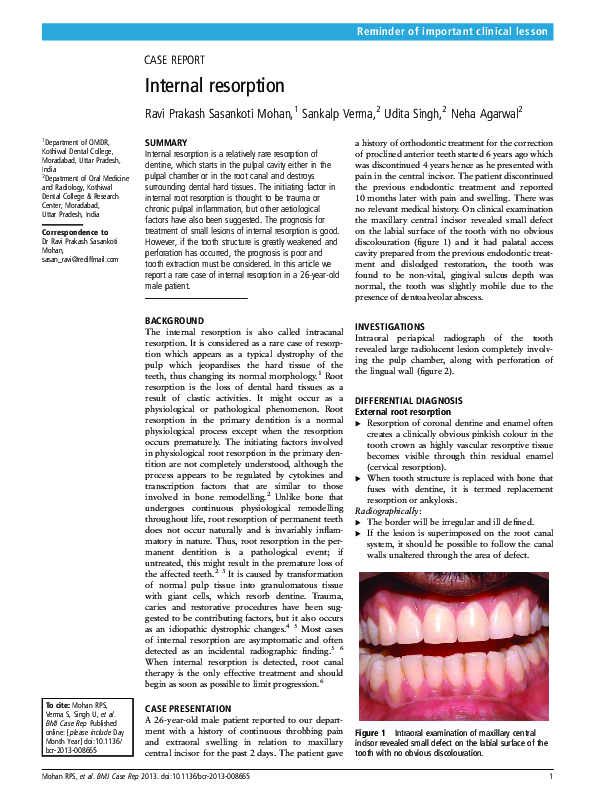 (PDF) Internal resorption