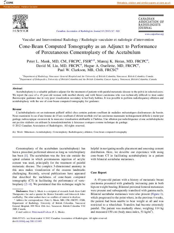 (PDF) Cone-Beam Computed Tomography as an Adjunct to Performance of Percutaneous Cementoplasty ...