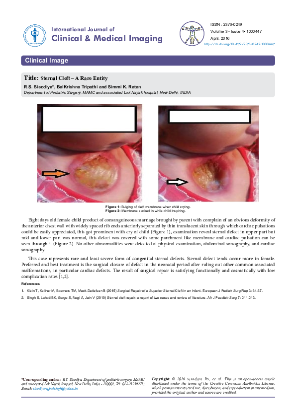 (PDF) Sternal Cleft – A Rare Entity
