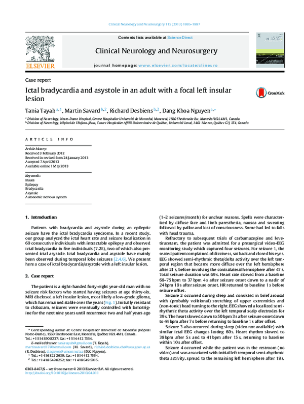 (PDF) Ictal bradycardia and asystole in an adult with a focal left ...