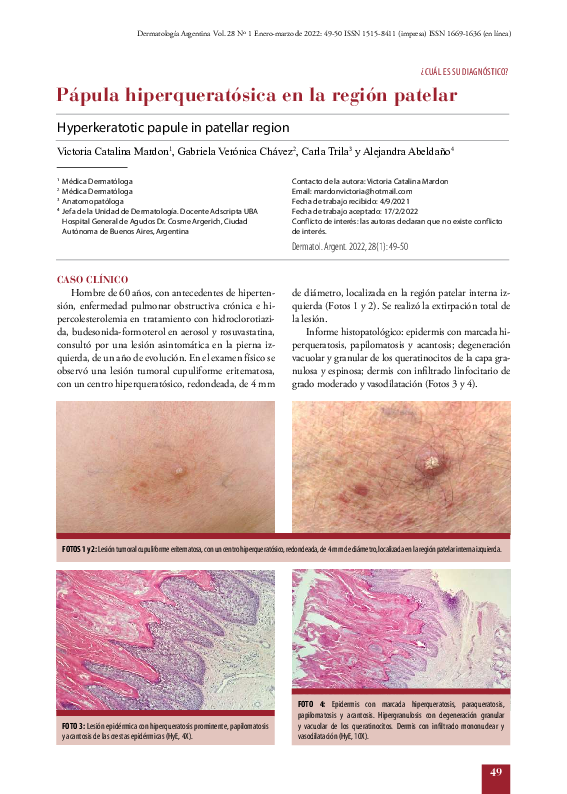 (PDF) Pápula hiperqueratósica en la región patelar