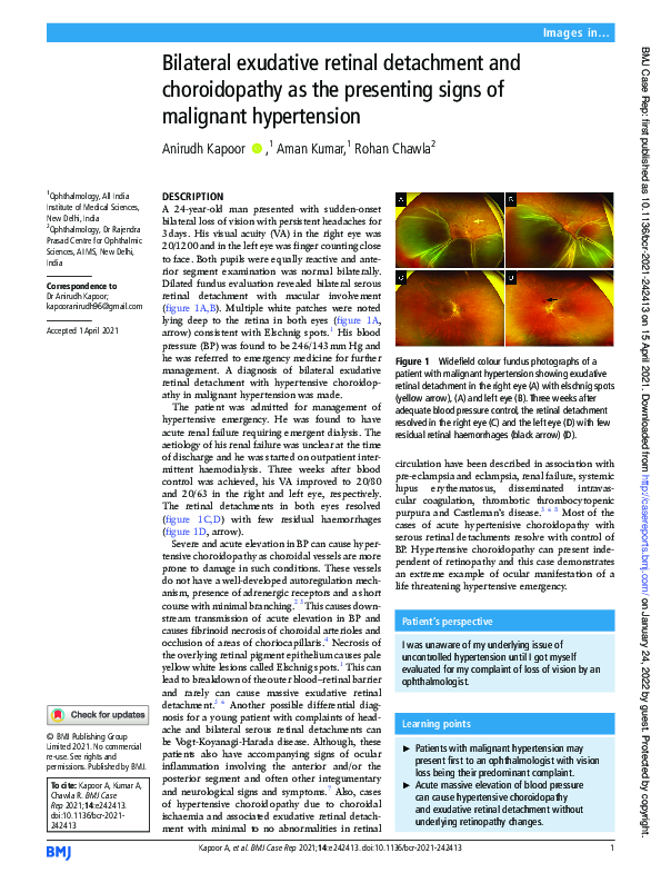 (PDF) Bilateral exudative retinal detachment and choroidopathy as the ...