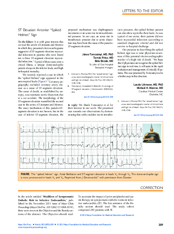 (PDF) ST Elevation Anterior “Spiked Helmet” Sign