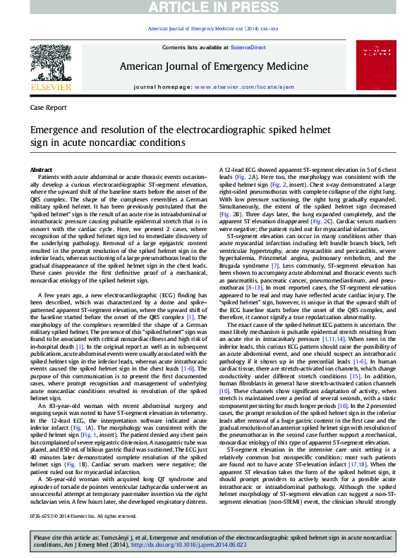 (PDF) Spiked helmet sign: An under-recognized electrocardiogram finding ...