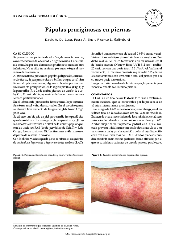 (PDF) Pápulas pruriginosas en piernas