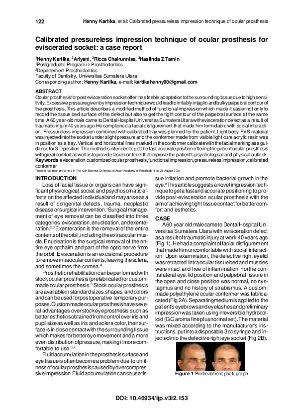 (PDF) Calibrated pressureless impression technique of ocular prosthesis ...