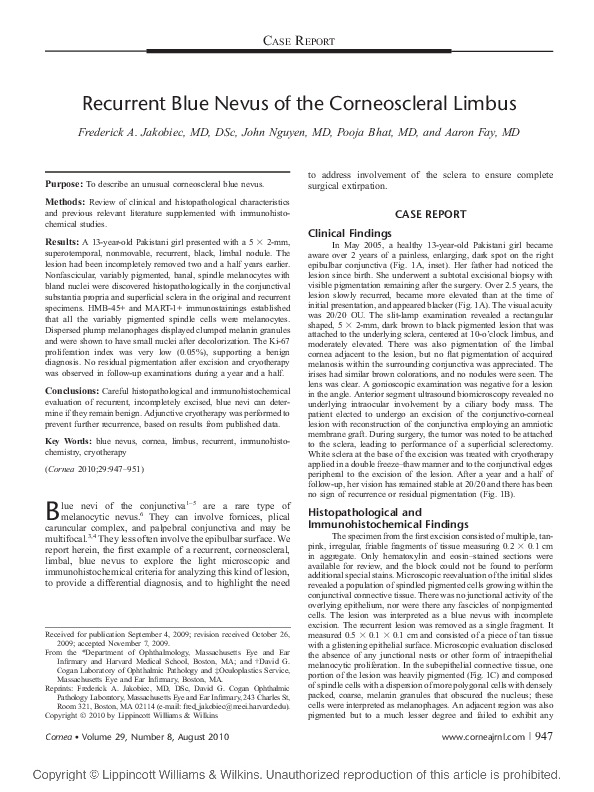 (PDF) Recurrent Blue Nevus of the Corneoscleral Limbus