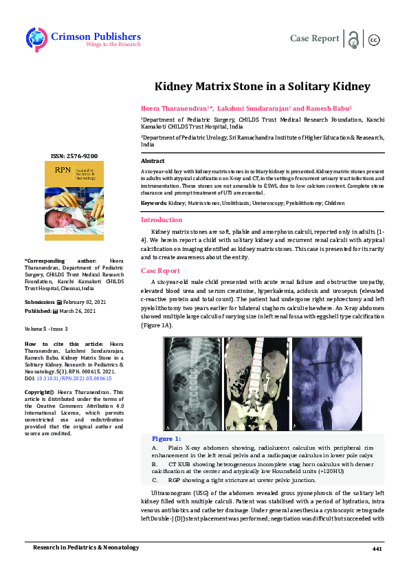 (PDF) Kidney Matrix Stone in a Solitary Kidney | Heera Tharanendran ...