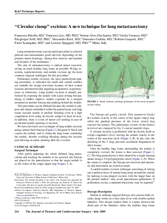 (PDF) “Circular clamp” excision: A new technique for lung ...