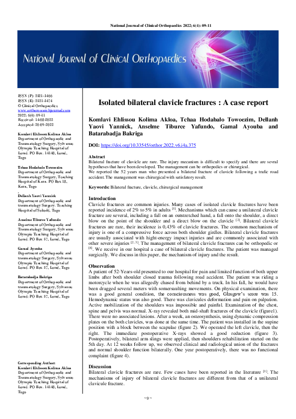 (PDF) Isolated bilateral clavicle fractures : A case report