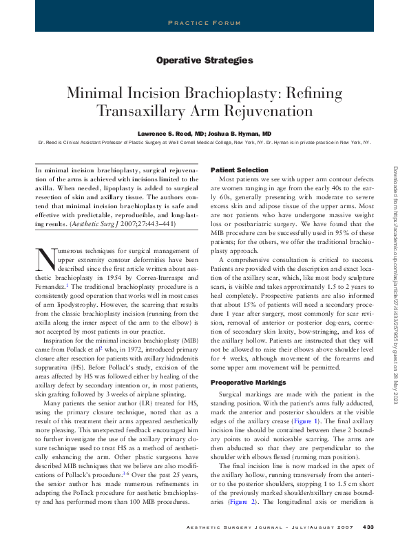 (PDF) Minimal incision brachioplasty: Refining transaxillary arm ...