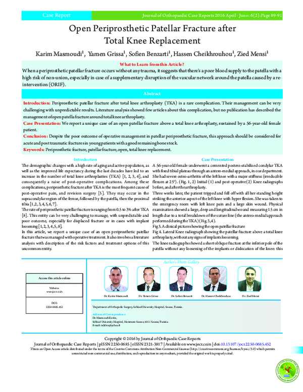 (PDF) Open Periprosthetic Patellar Fracture after Total Knee Replacement