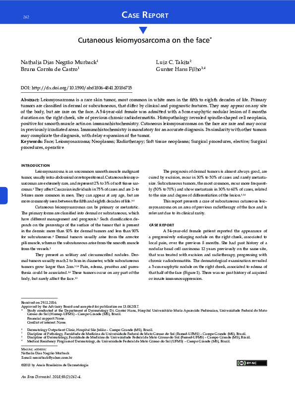 (PDF) Cutaneous leiomyosarcoma on the face