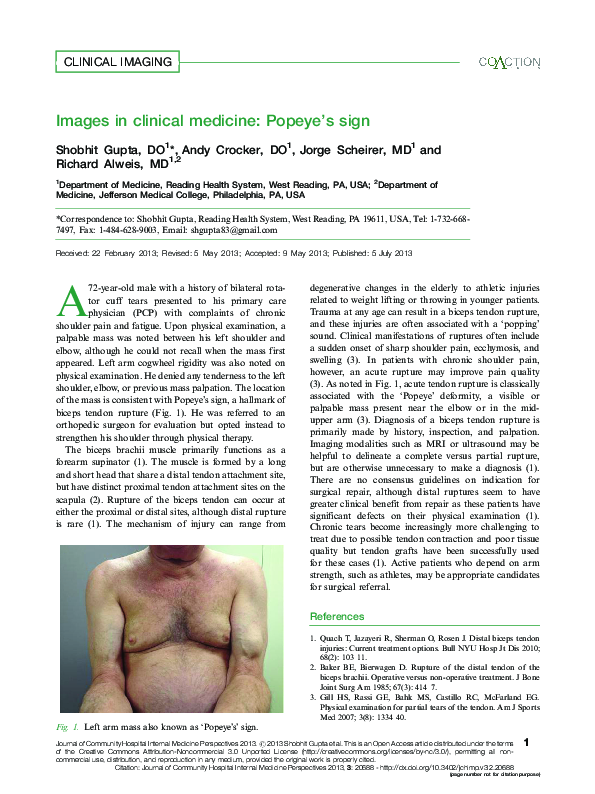 (PDF) Images in clinical medicine: Popeye's sign | Shobhit Gupta ...
