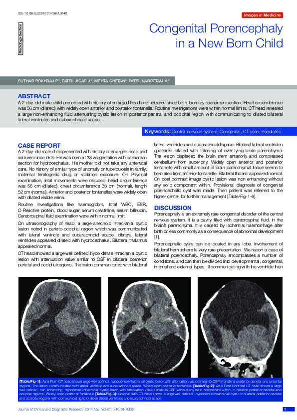 (PDF) Congenital Porencephaly in a New Born Child