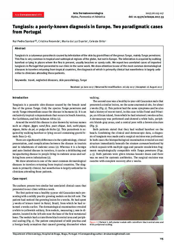 (PDF) Tungiasis: a poorly-known diagnosis in Europe. Two paradigmatic cases from Portugal