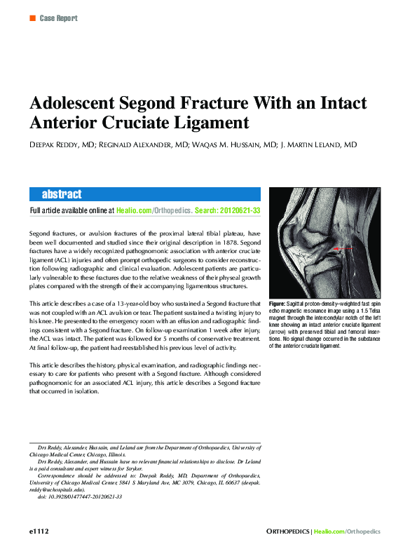 (PDF) Adolescent Segond Fracture With an Intact Anterior Cruciate ...