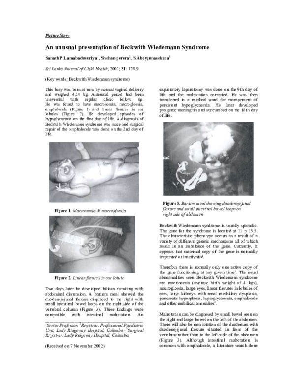(PDF) An unusual presentation of Beckwith Wiedemann Syndrome