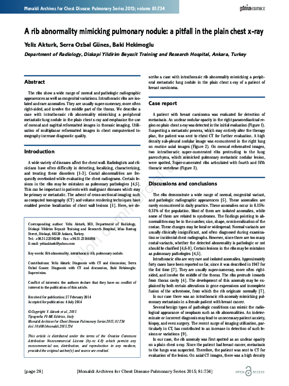 (PDF) A rib abnormality mimicking pulmonary nodule: a pitfall in the ...