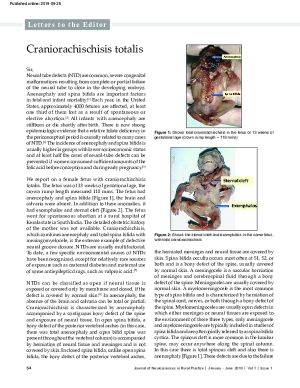 (PDF) Craniorachischisis totalis