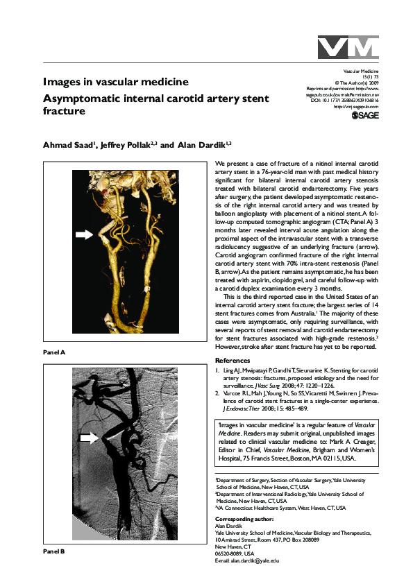 (PDF) Images in vascular medicine: Asymptomatic internal carotid artery ...