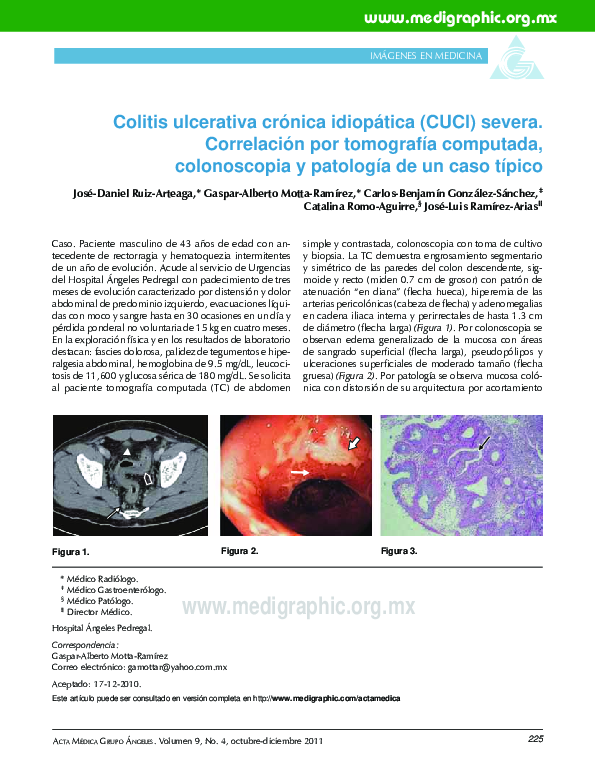(PDF) Colitis ulcerativa crónica idiopática (CUCI) severa. Correlación ...