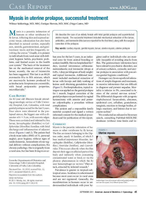 (PDF) Myasis in uterine prolapse, successful treatment