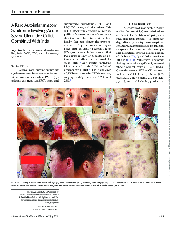 (PDF) A Rare Autoinflammatory Syndrome Involving Acute Severe ...