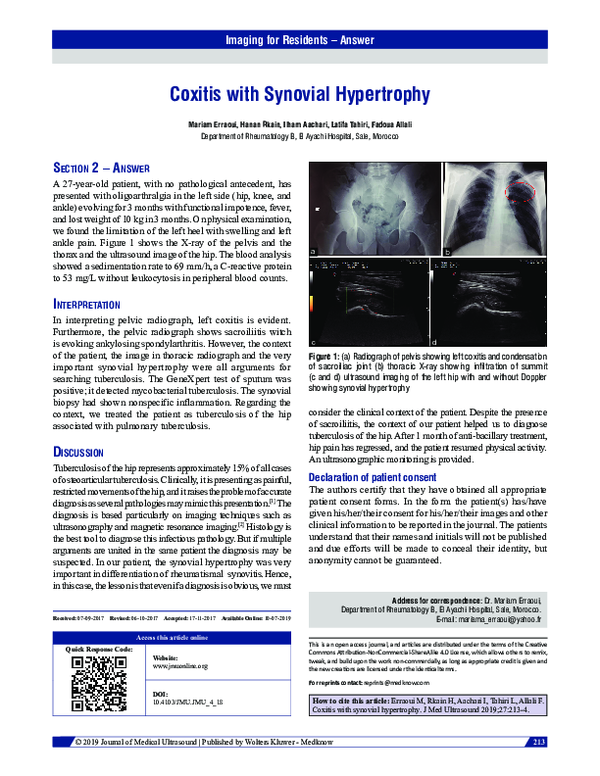 (PDF) Coxitis with synovial hypertrophy | Hanan RKAIN - Academia.edu