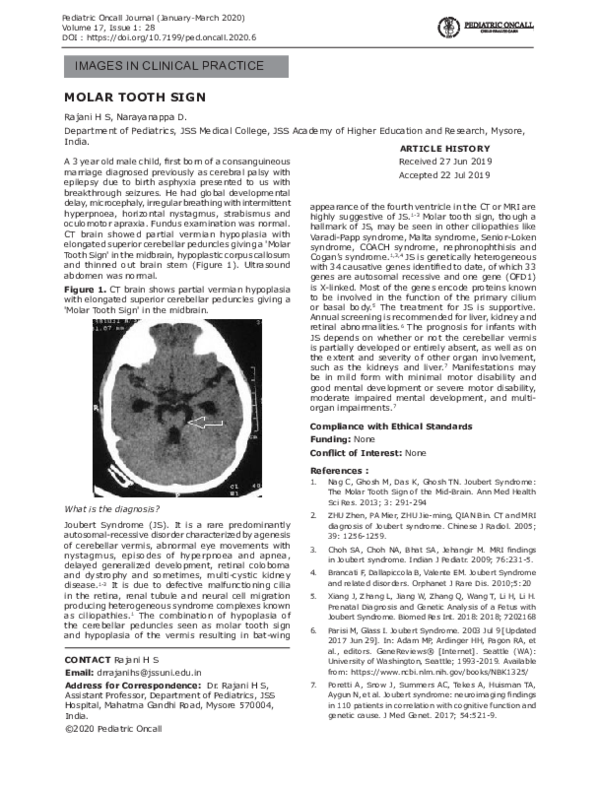 (PDF) Molar Tooth Sign