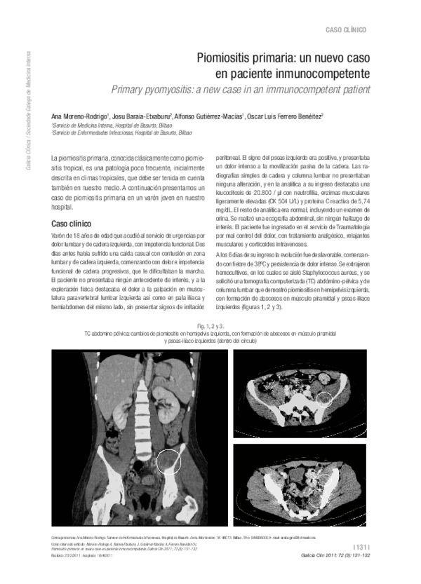 (PDF) Piomiositis primaria: un nuevo caso en paciente inmunocompetente
