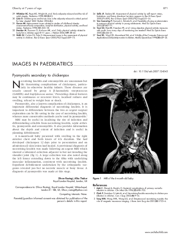(PDF) Pyomyositis secondary to chickenpox