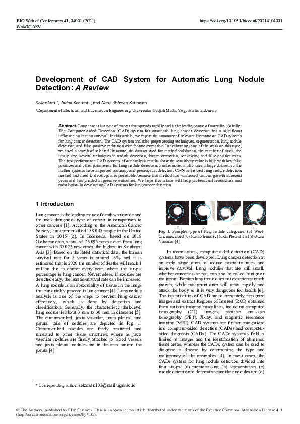 Pdf Development Of Cad System For Automatic Lung Nodule Detection A Review
