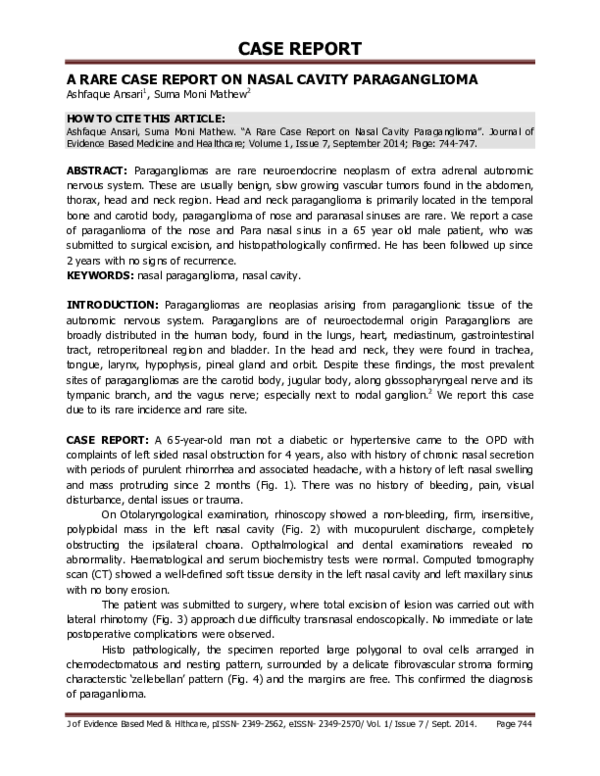 (PDF) A Rare Case Report on Nasal Cavity Paraganglioma